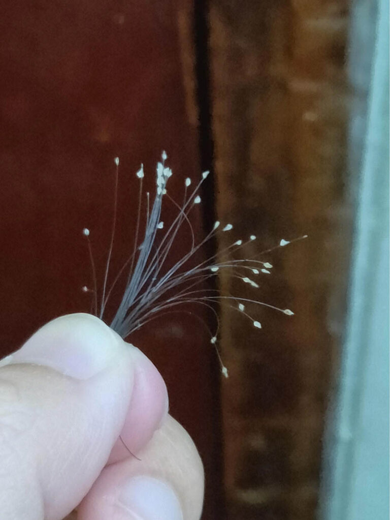 Nguyên nhân tóc rụng có hạt trắng ở chân tóc, liệu có phải sắp bị hói?